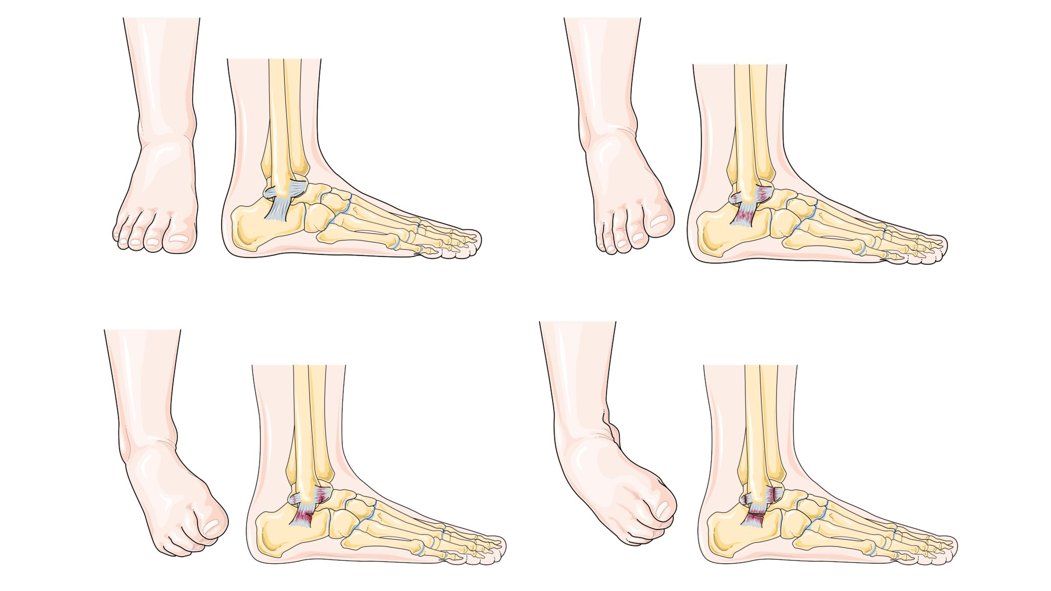 Ankle Sprain, Instability & Foot pain – Bild Clinic